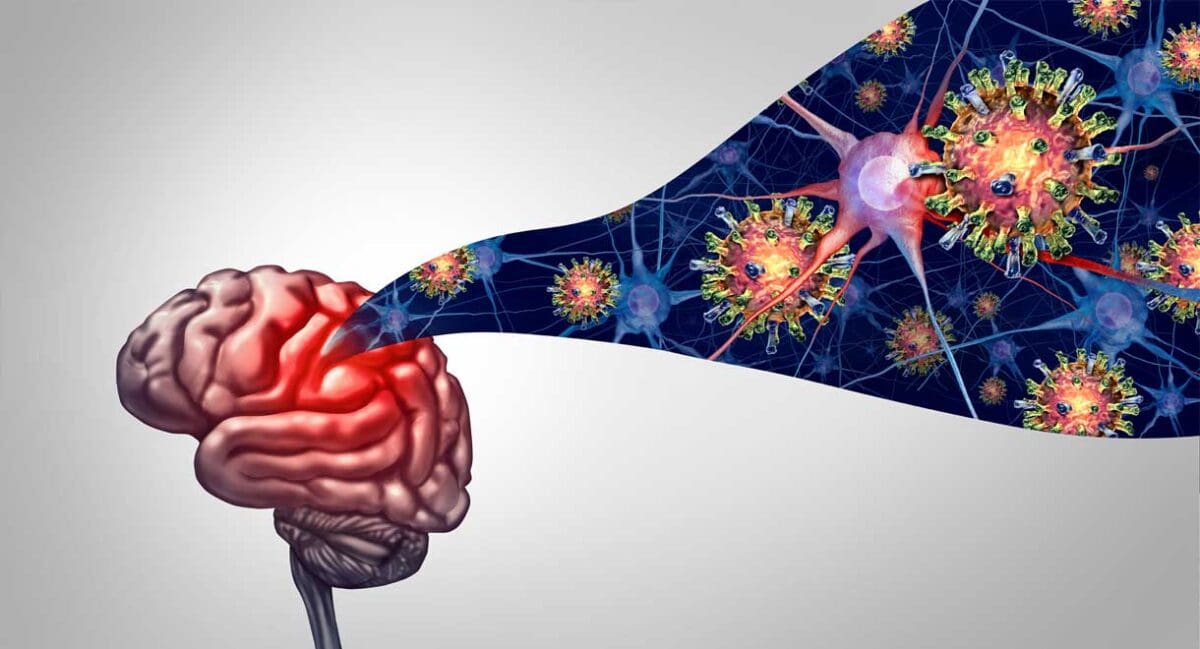 Brain Inflammation - What You Need To Know - Dr Sandra Cabot MD