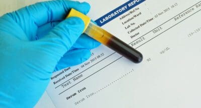 Iron Studies - Understanding Your Blood Test Results - Dr Sandra Cabot MD